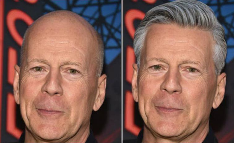 Famosos ¿con o sin cabello? | Contexto Tucuman