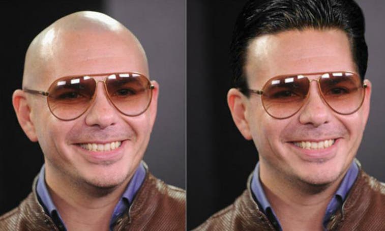 Famosos ¿con o sin cabello? | Contexto Tucuman