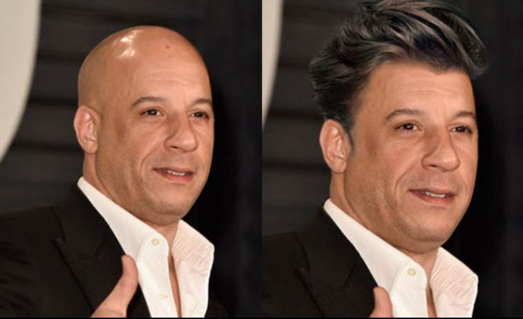 Famosos ¿con o sin cabello? | Contexto Tucuman