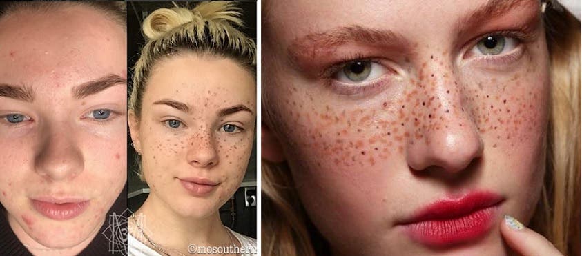 Freckling: la moda que consiste en tatuarse pecas en el rostro ...