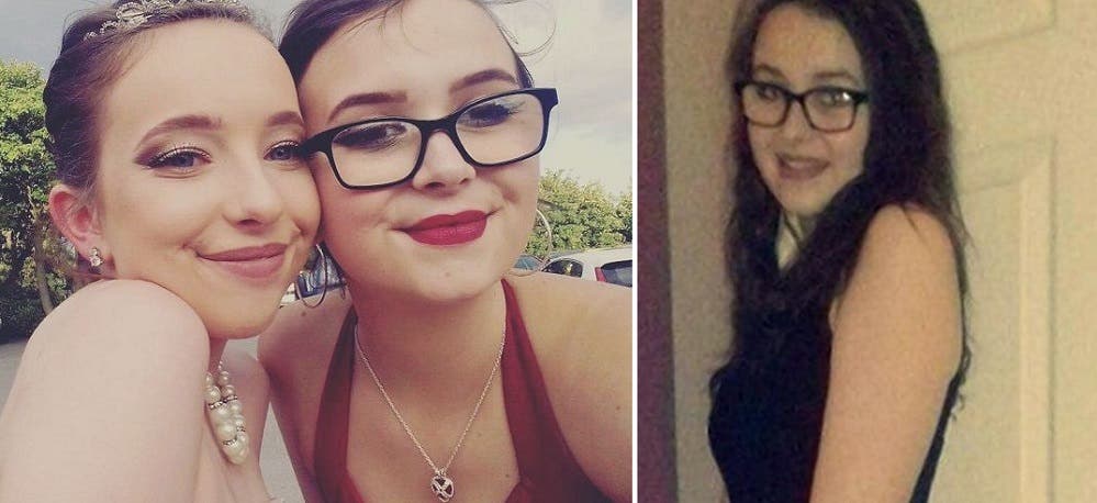 El síndrome de Rapunzel terminó con la vida de esta joven chica ...