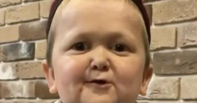 La historia de Hasbullah Magomedov: el joven que parece un niño de 5 ...